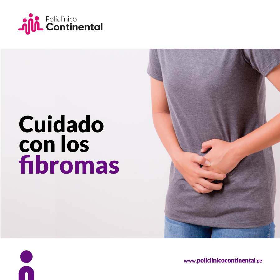 Cuidado con los fibromas - Policlinico Continental